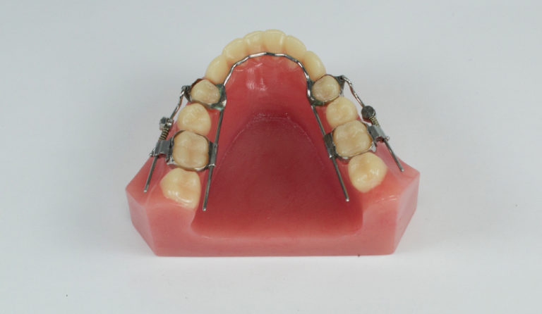 C.D. Distalizer - Johns Dental