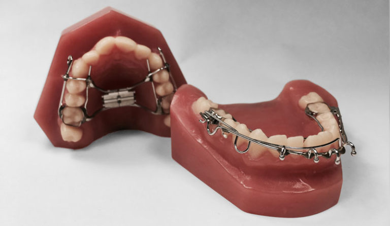 Tandem – Johns Dental Lab