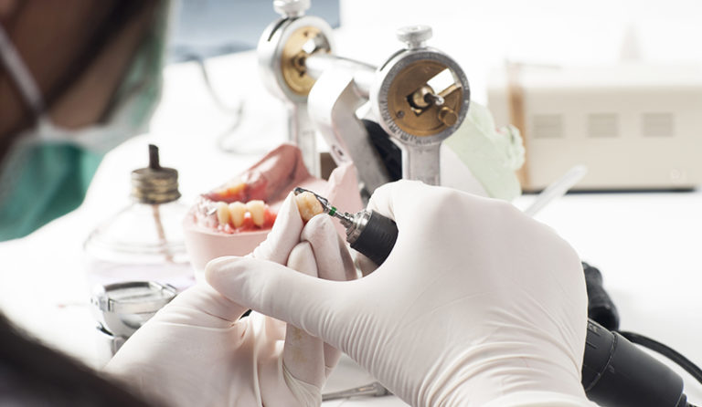 Tooth Positioner Johns Dental Lab - Johns Dental Lab