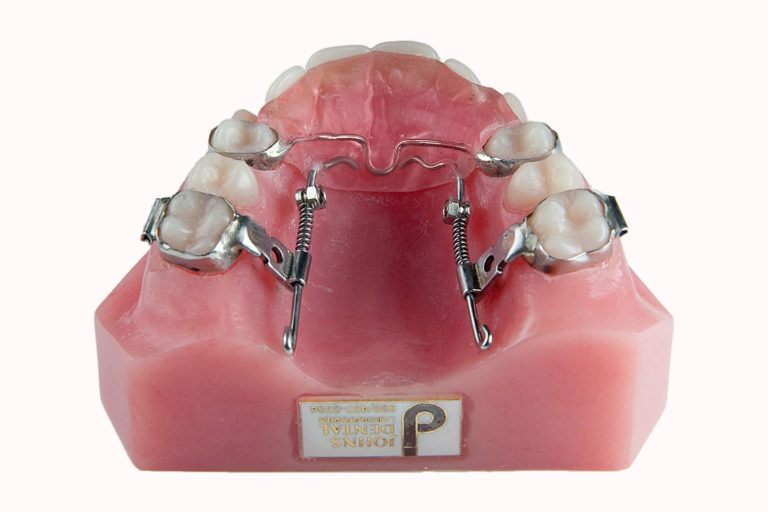 Keles Slider - Johns Dental Lab