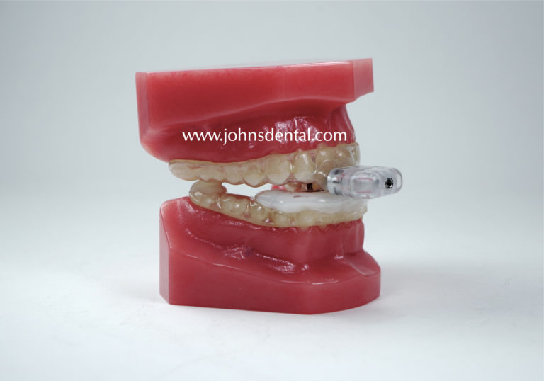 TAP® - Johns Dental Lab