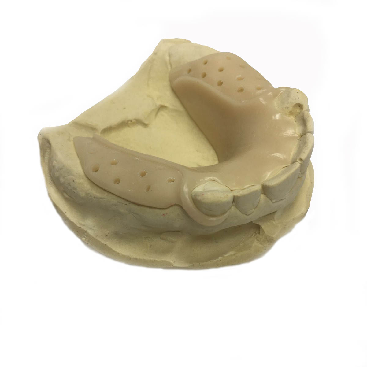 acetal_frame - Johns Dental Lab
