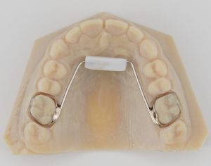 Bluegrass Habit - Johns Dental Lab