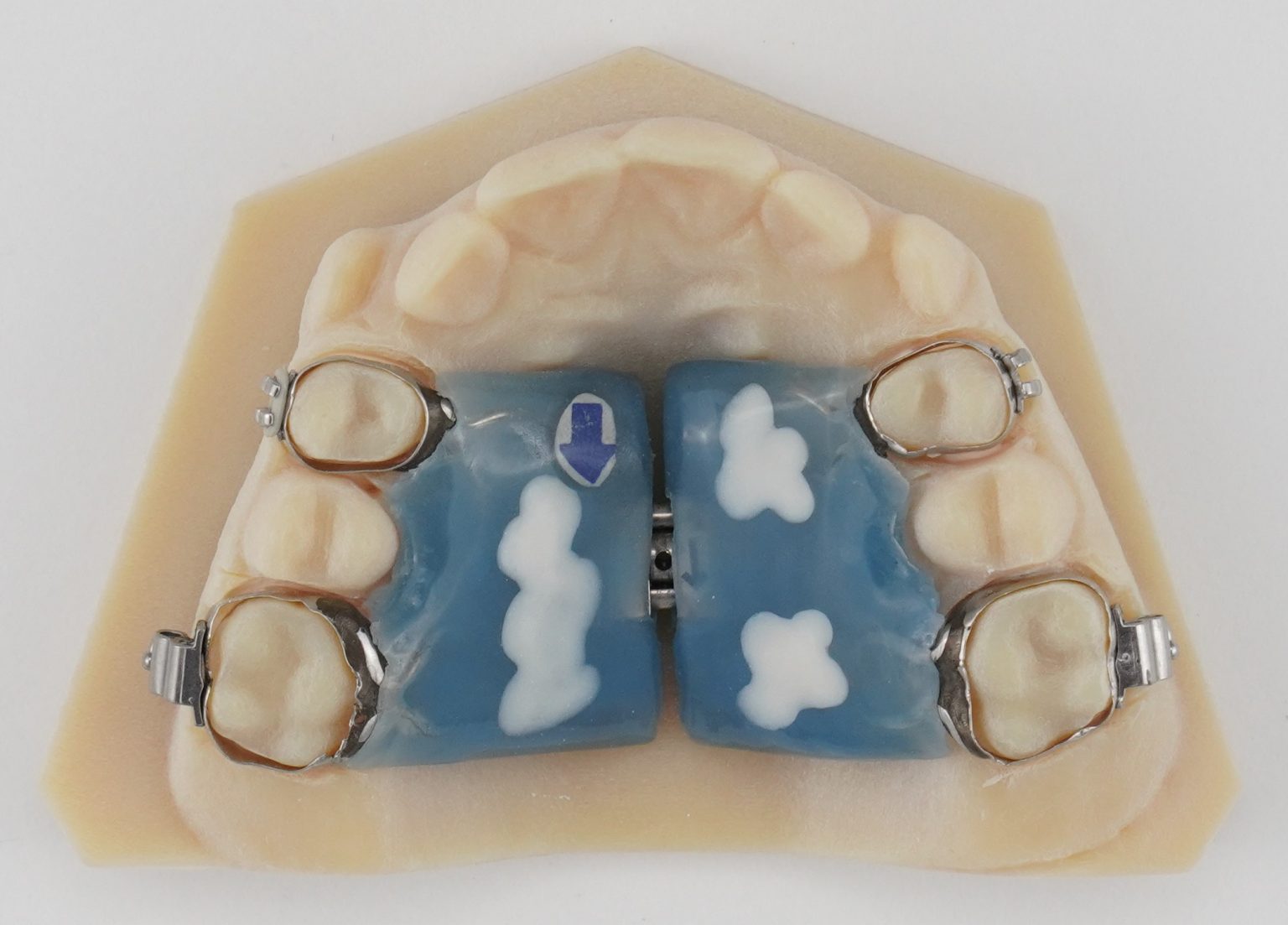 Haas - Johns Dental Lab