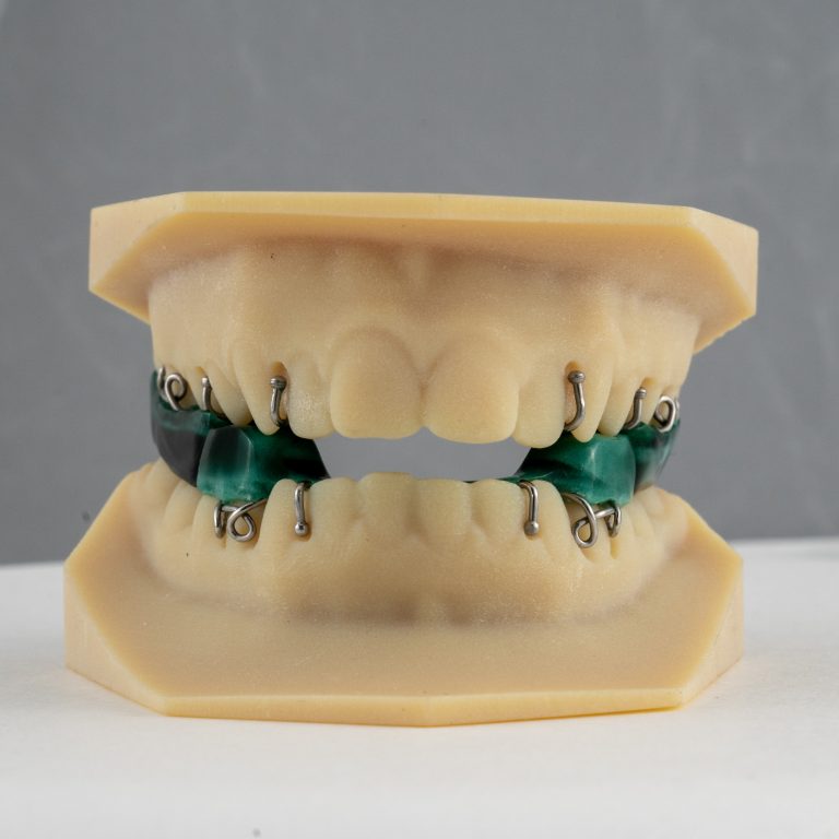 Twin Block - Johns Dental Lab