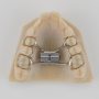 Hyrax - Johns Dental Lab